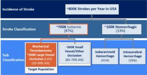 Stroke : NeuroTrauma Sciences